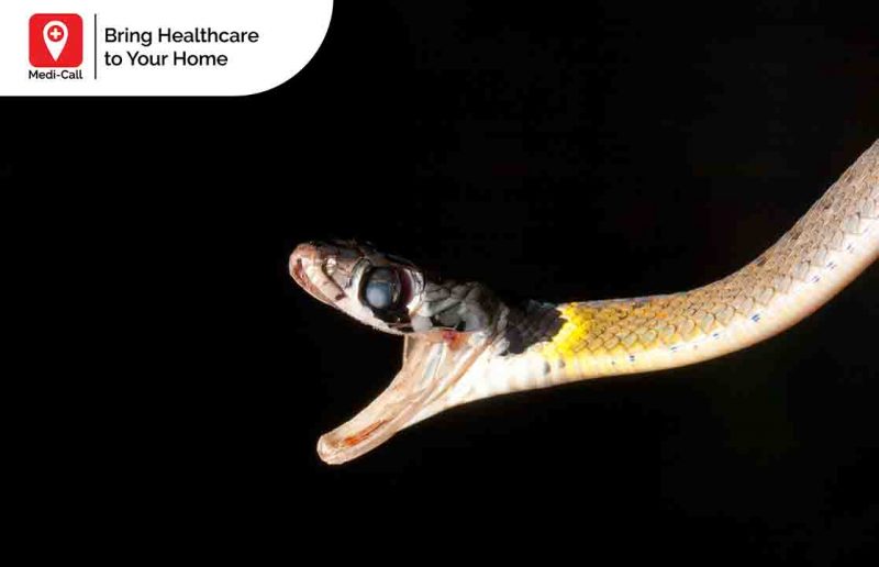 Snake Bite First Aid: Important DOs and DON’Ts for Snake Bites