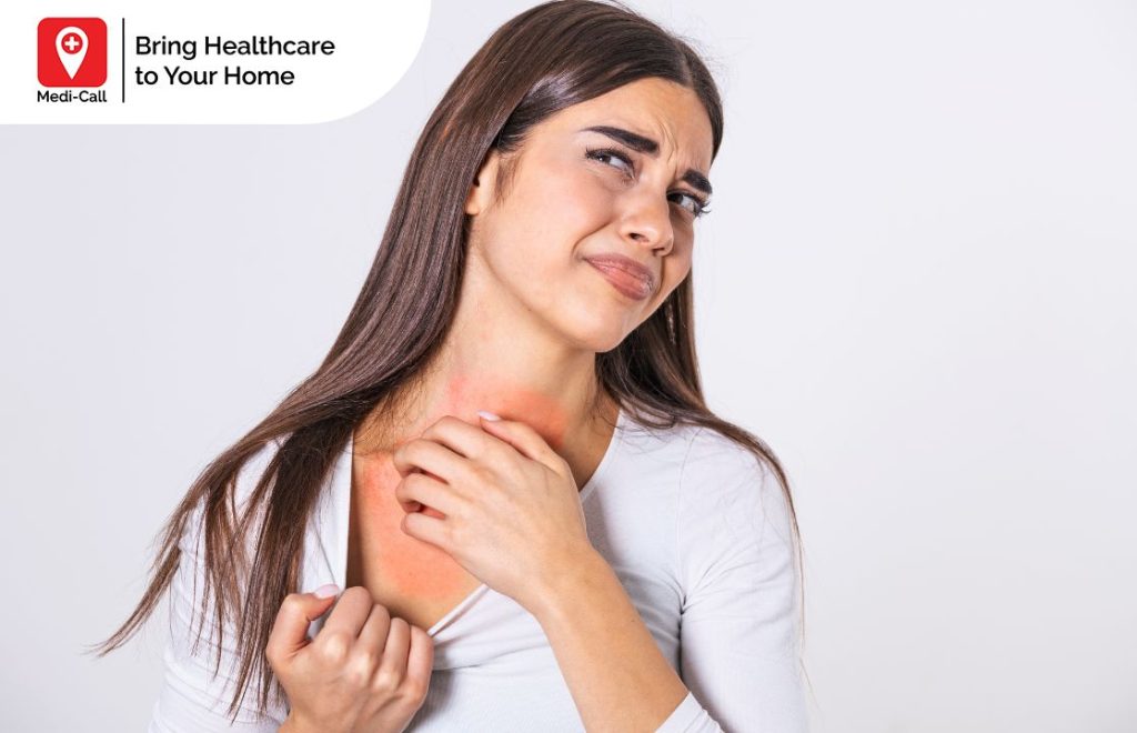 Bentol Merah Gatal di Wajah dan Kulit, Penyebab dan Penanganannya