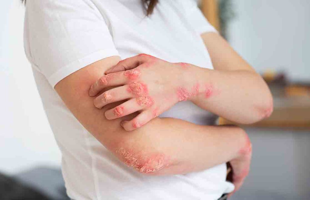 Apa Itu Panti Jompo? Kenali Layanan dan Cara Memilihnya - Medi Call Blog